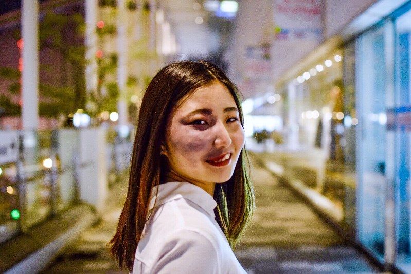 21-yr-old Instagrammer with facial birthmark challenging Japan's ...