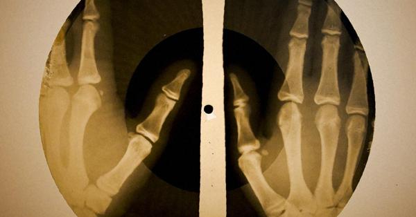 Bad to the bone: Soviet-era pirate records made from X-ray plates on ...
