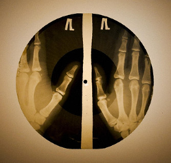 Bad to the bone: Soviet-era pirate records made from X-ray plates on ...