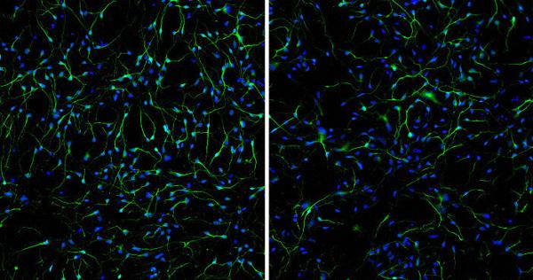 Japan researchers identify link between autism and gene mutation - The ...