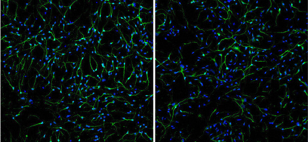 Japan researchers identify link between autism and gene mutation - The ...
