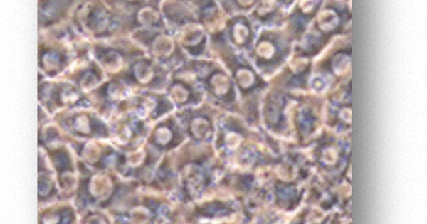 1st transplant using liver cells from embryonic stem cells conducted on ...