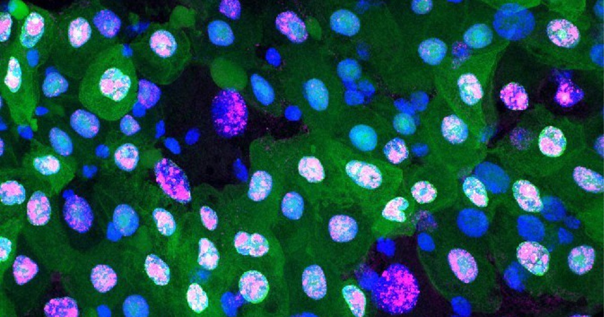 Japan research team finds new 'erebosis' cell death mechanism ...