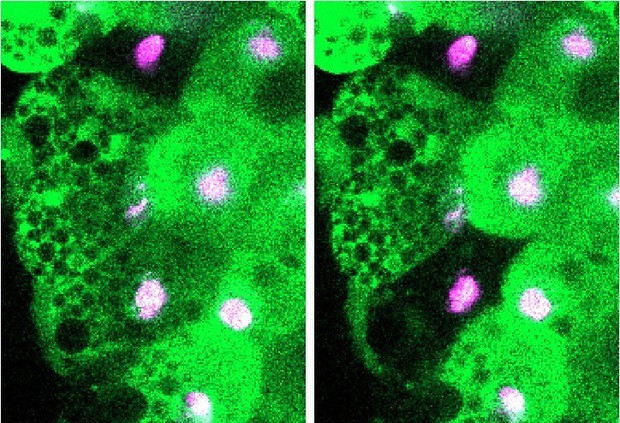 Japan research team finds new 'erebosis' cell death mechanism ...