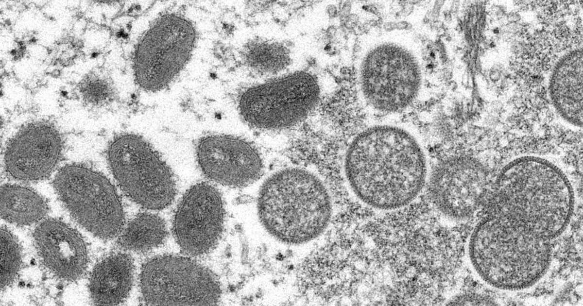 Monkeypox cases triple in Europe, WHO says, Africa concerned - The Mainichi