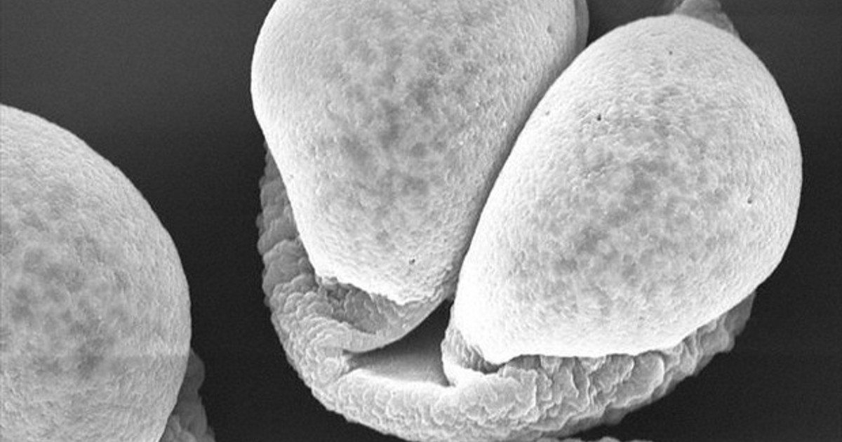 In Photos: Nature's wild variety shines through in pollen images - The ...