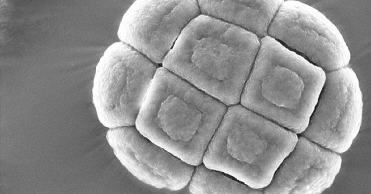 In Photos: Nature's wild variety shines through in pollen images - The ...