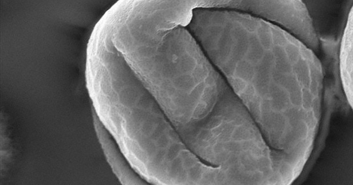 In Photos: Nature's wild variety shines through in pollen images - The ...