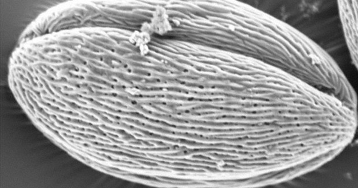 In Photos: Nature's wild variety shines through in pollen images - The ...