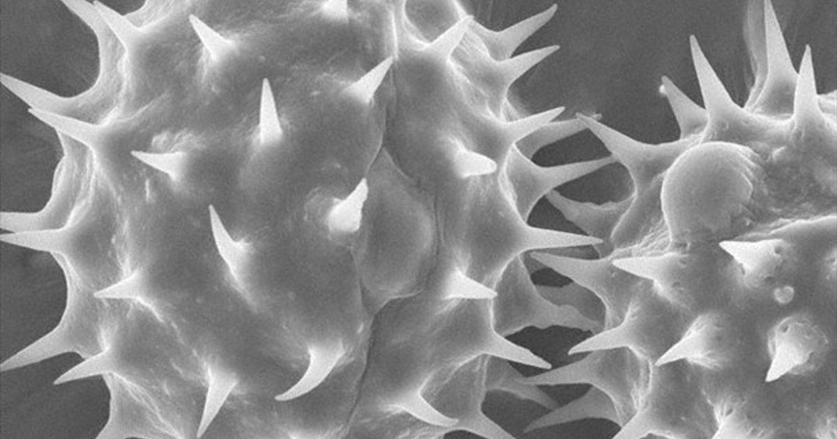 Pollen image database at Japanese univ. offers unique microcosm of ...