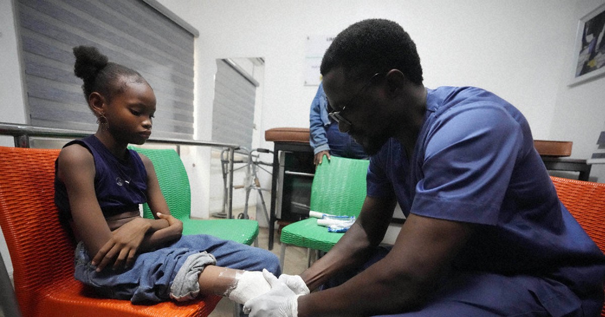 Nigerian group provides hundreds of prosthetic limbs to amputee ...