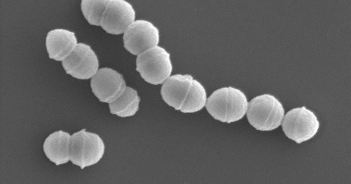 Cases of strep bacterial infection with extremely high death rate hit ...