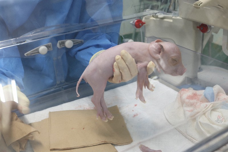 Editorial: Japan's pig-human xenotransplants a step toward saving lives ...