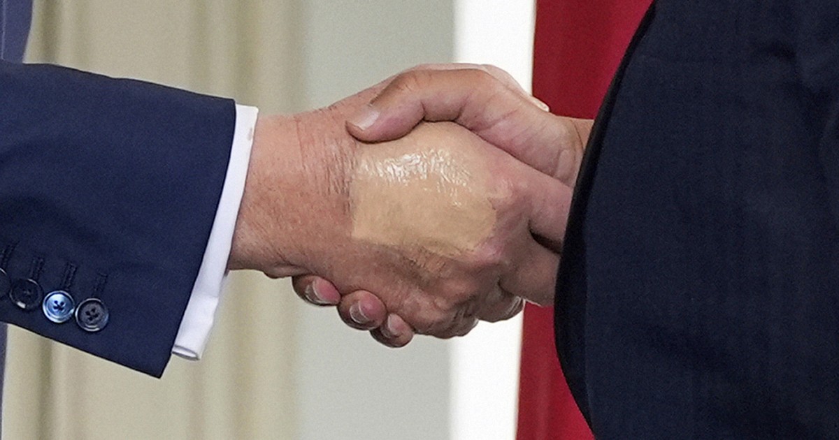 トランプ氏の写真に異変 ホワイトハウス、「慢性静脈不全」と明かす [写真特集1/5] | 毎日新聞