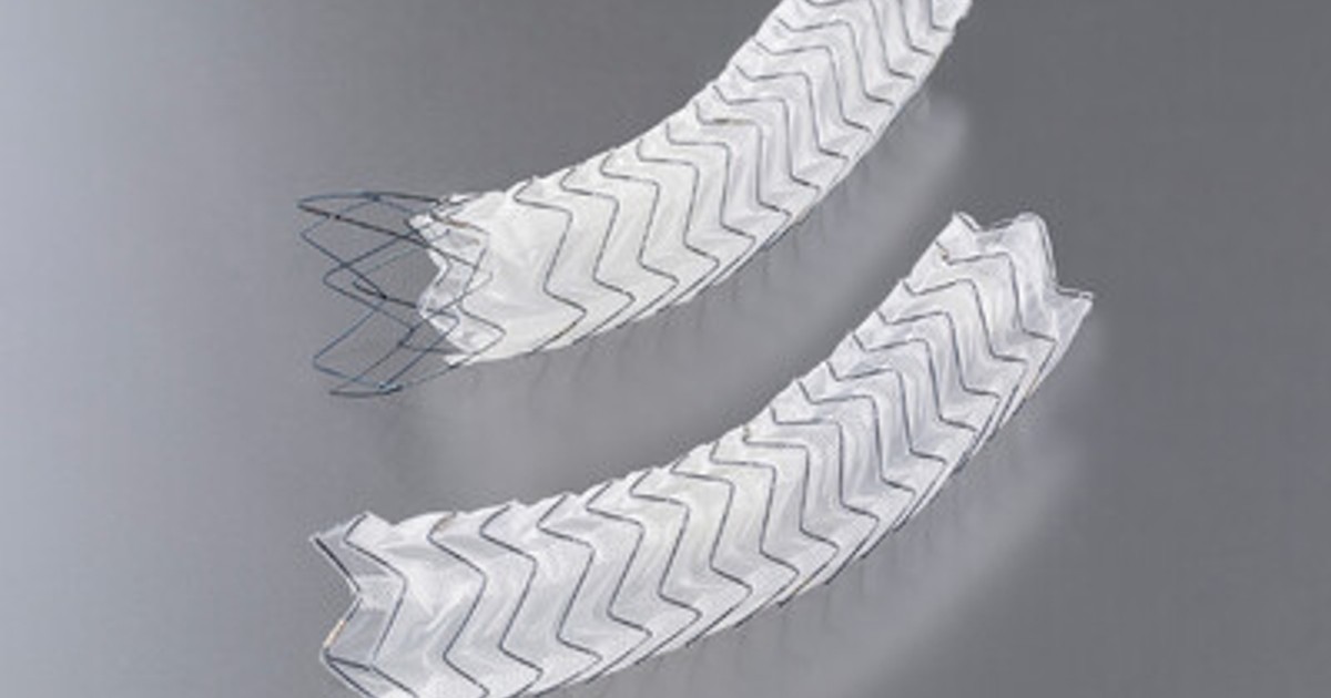 プレスリリース：大腸ステント・胃十二指腸ステントの販売提携について（PR TIMES） | 毎日新聞