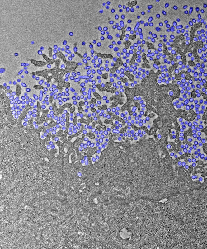 Avian flu virus can remain infectious in milk for over 5 months: Tokyo ...